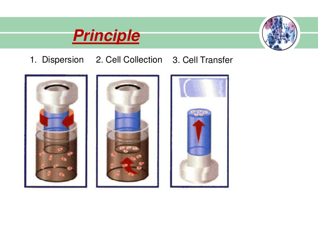 Cell block and liquid based cytology