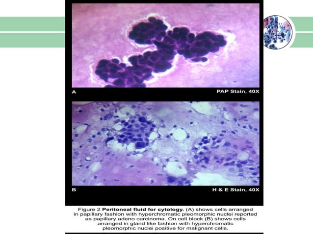 cellblockCYTOLOGY MLTdiss1-170425170805.ppt