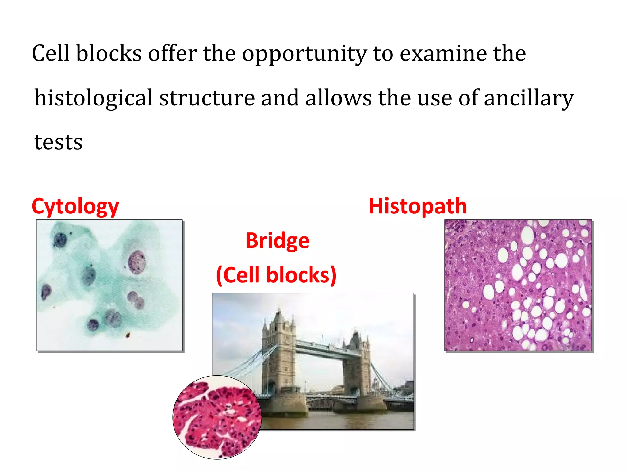 Cell block in cytology | PPT