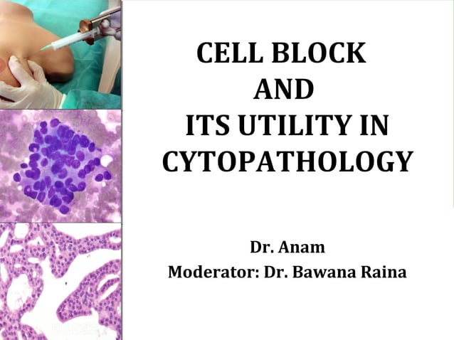 Cell block in cytology | PPT
