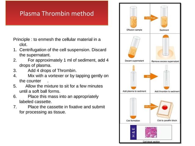 Cell block in cytology | PPT