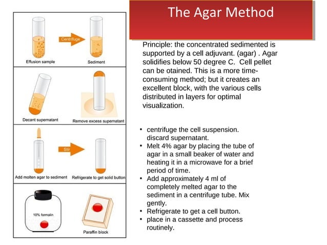 Cell block in cytology | PPT