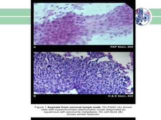 Cell block in cytology | PPT