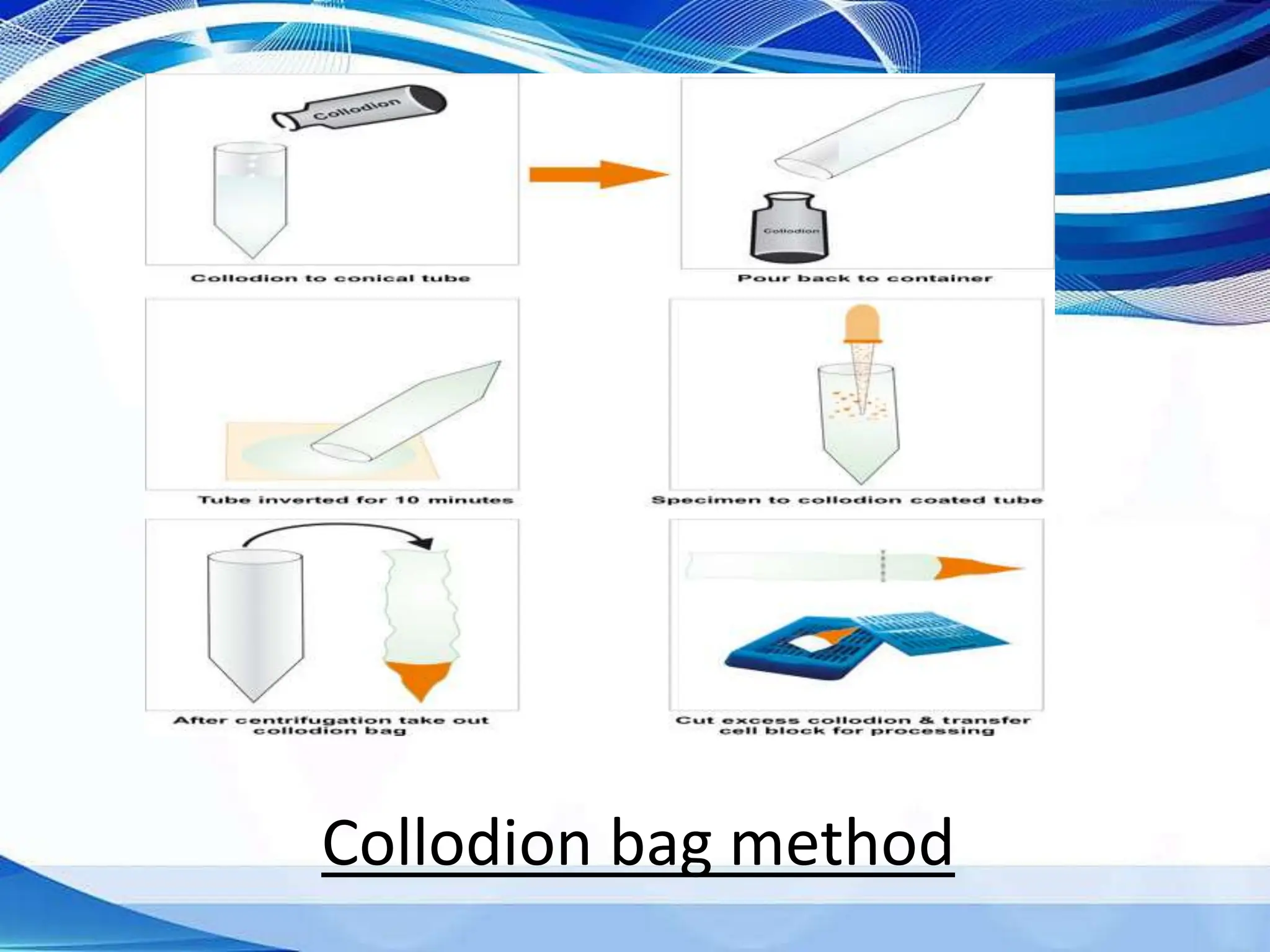 CELL BLOCK PREPARATION AND ITS IMPORTANCE | PPTX