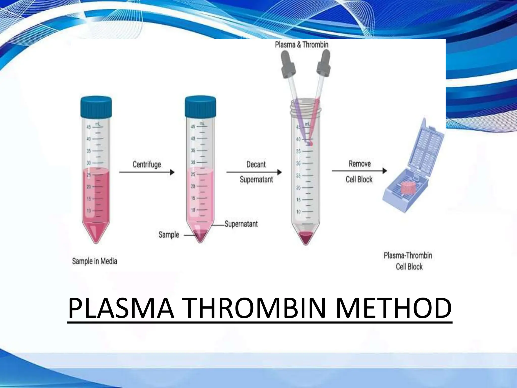 CELL BLOCK PREPARATION AND ITS IMPORTANCE | PPTX