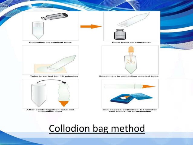 CELL BLOCK PREPARATION AND ITS IMPORTANCE | PPTX