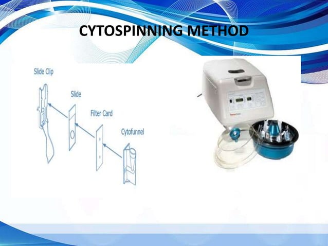 CELL BLOCK PREPARATION AND ITS IMPORTANCE | PPTX