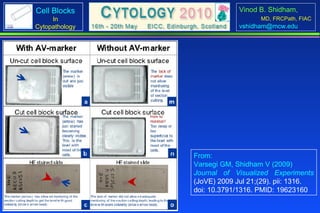 Cell blocks in cytol (iac wrkshp i) 5 11-10 | PPT