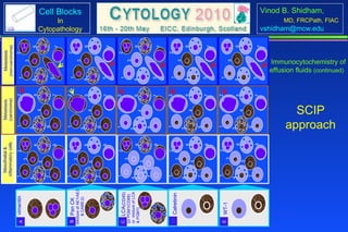 Cell blocks in cytol (iac wrkshp i) 5 11-10 | PPT