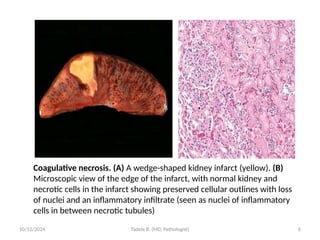Cell death, free radical injury and.pptx