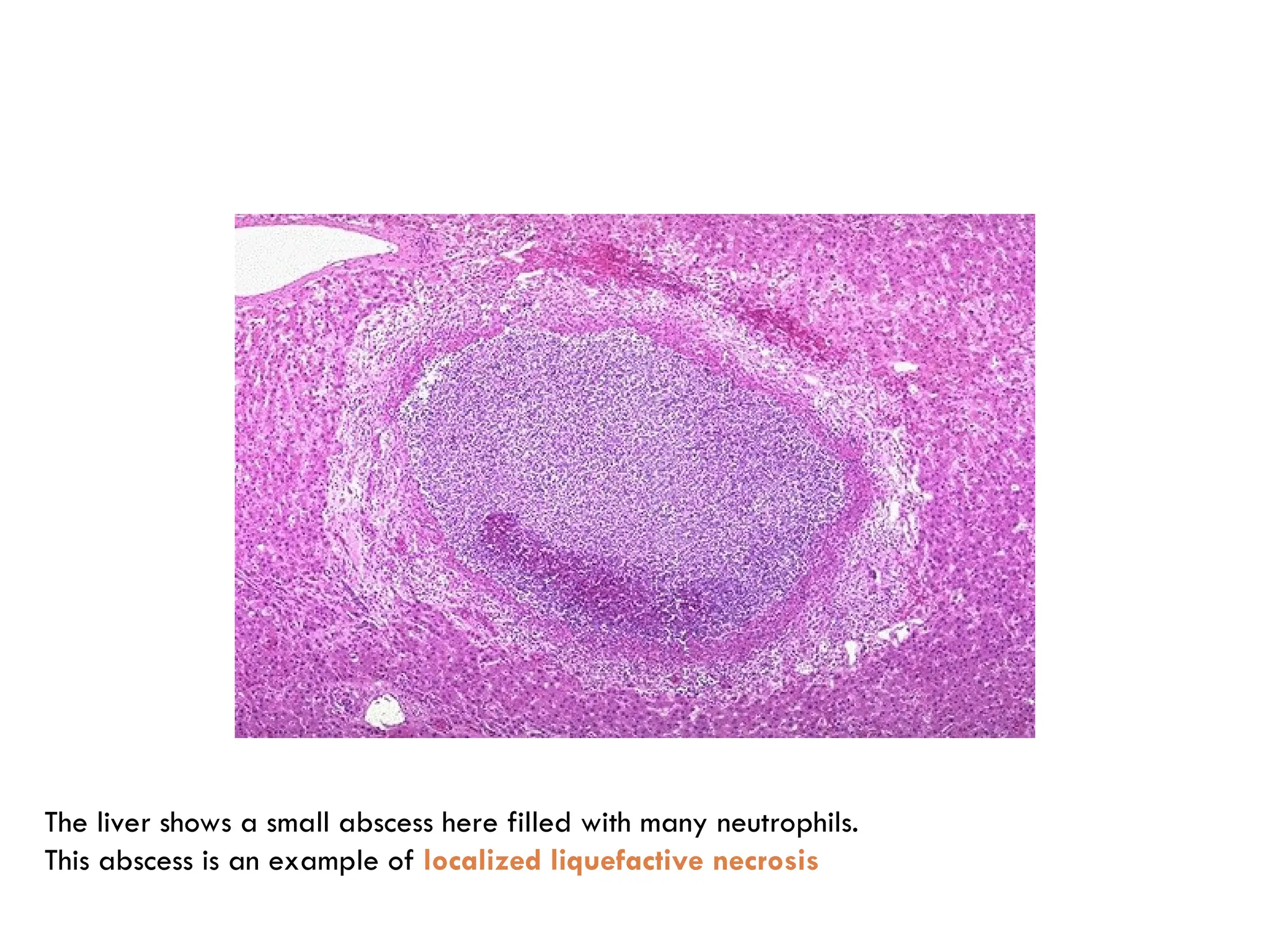 cell death & necrosis.pptddrghfddetygfdeee | PPT
