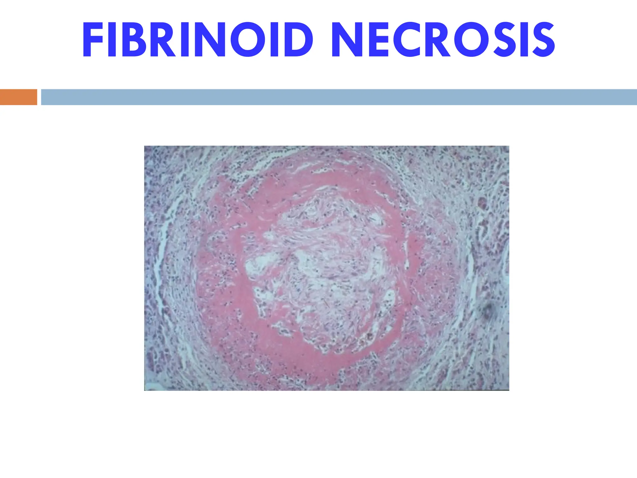 cell death & necrosis.pptddrghfddetygfdeee | PPT