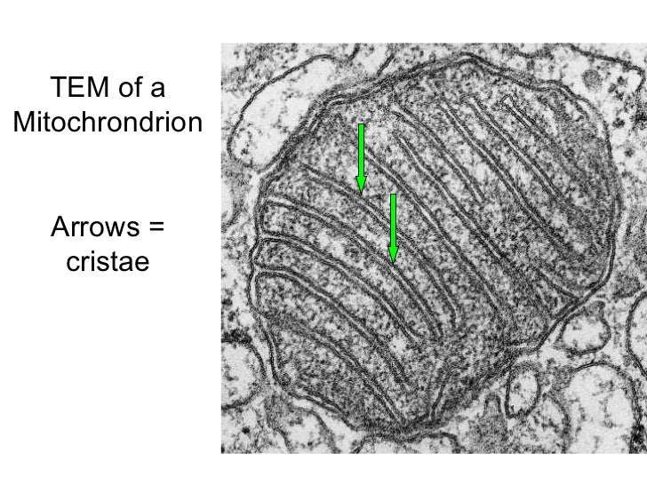 What Is Difference Between Cristae And Cisternae Quora