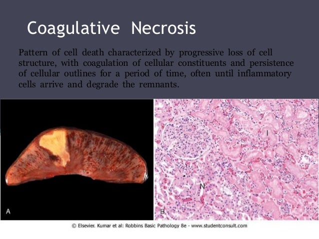 Cell injury inflammation and repair