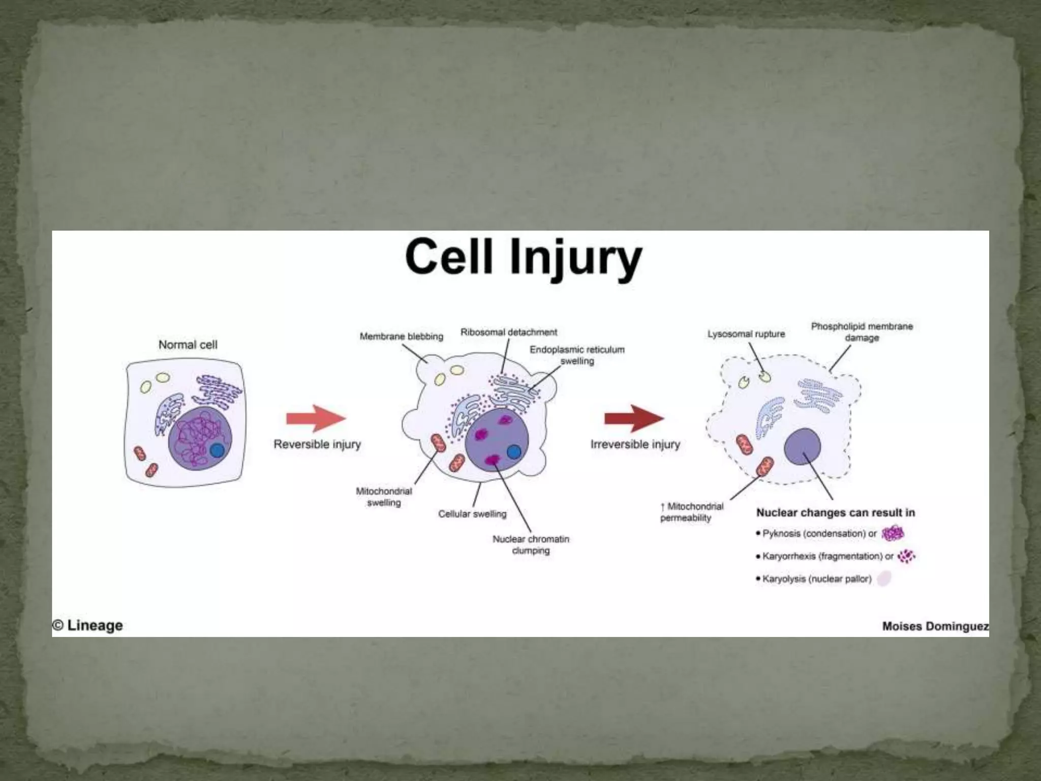 Cell injury | PPTX