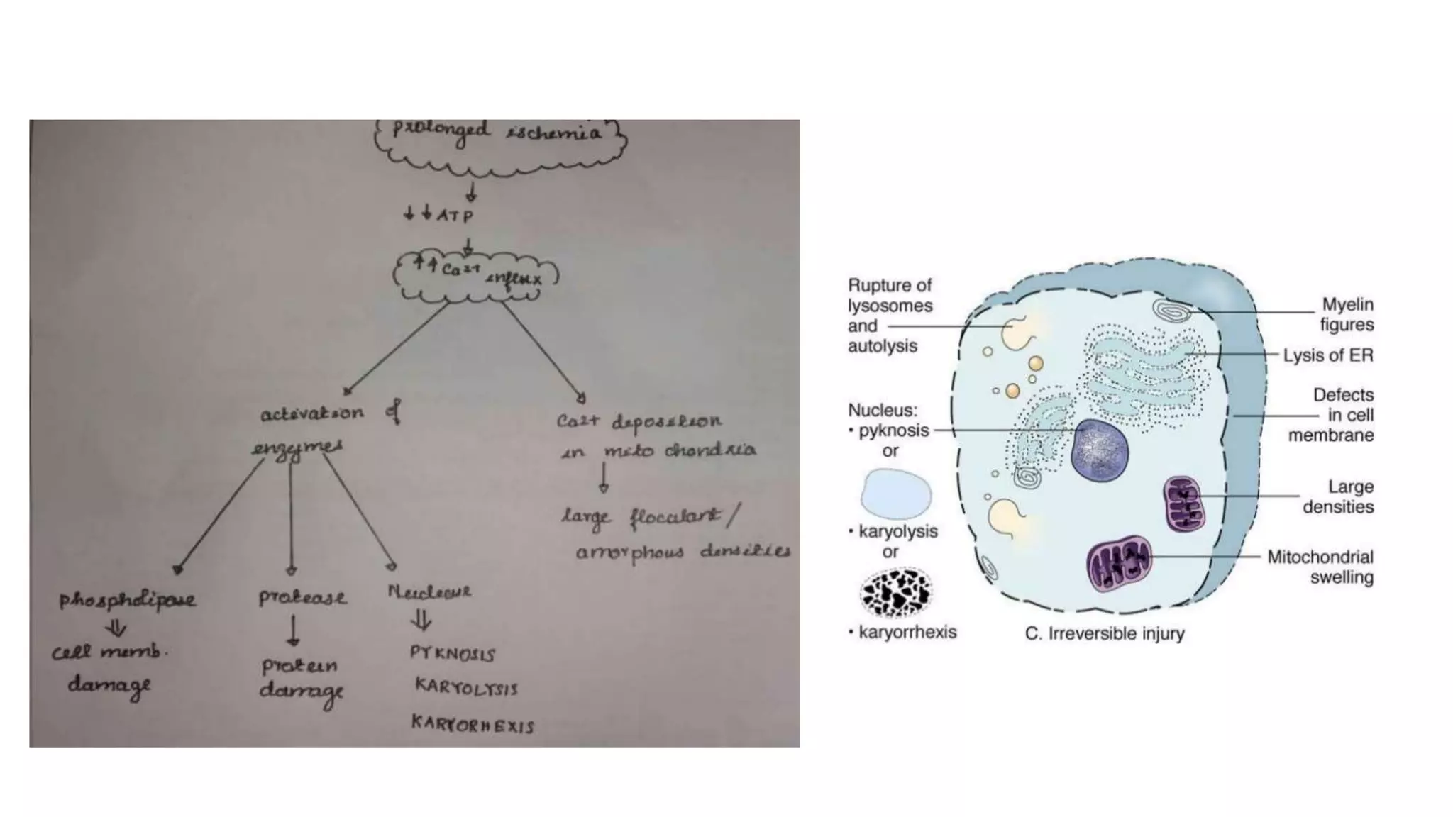 Cell injury pathology revision notes | PPTX