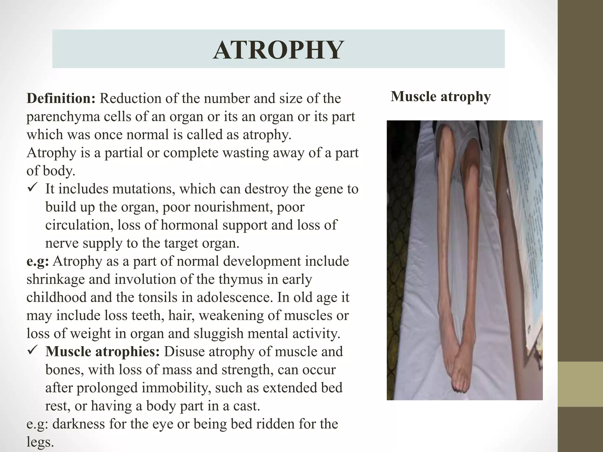 Basic principles of Cell injury and Adaptation | PPTX