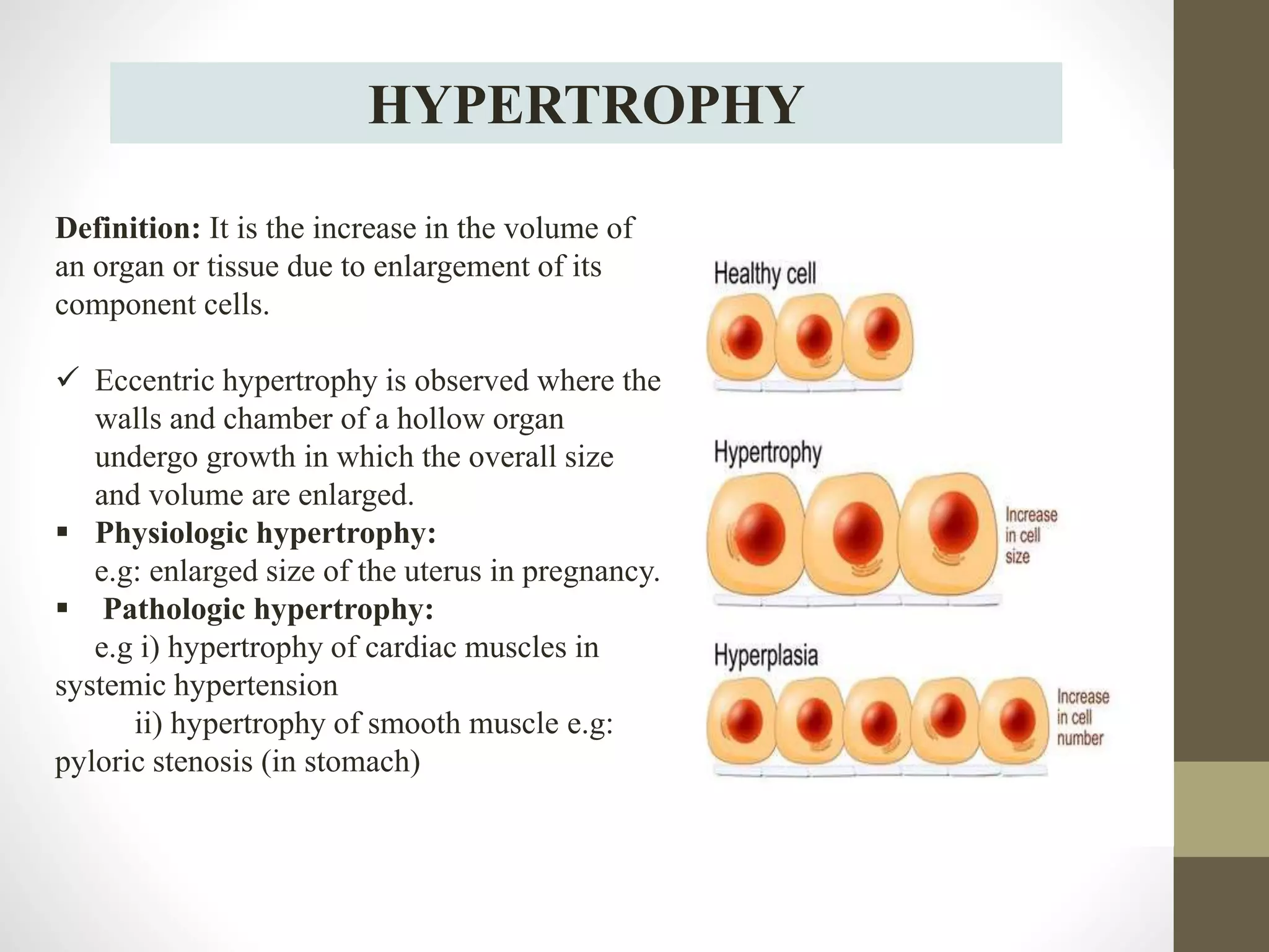 Basic principles of Cell injury and Adaptation | PPTX