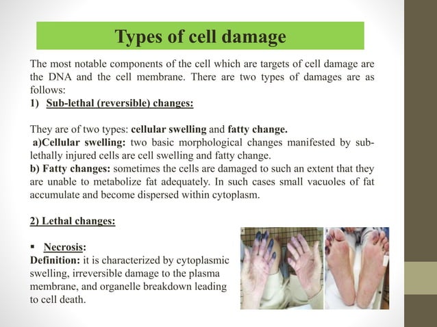 Basic principles of Cell injury and Adaptation | PPTX