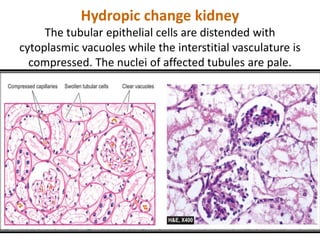 Morphology of Cell injury by Dr. Roopam Jain | PPTX