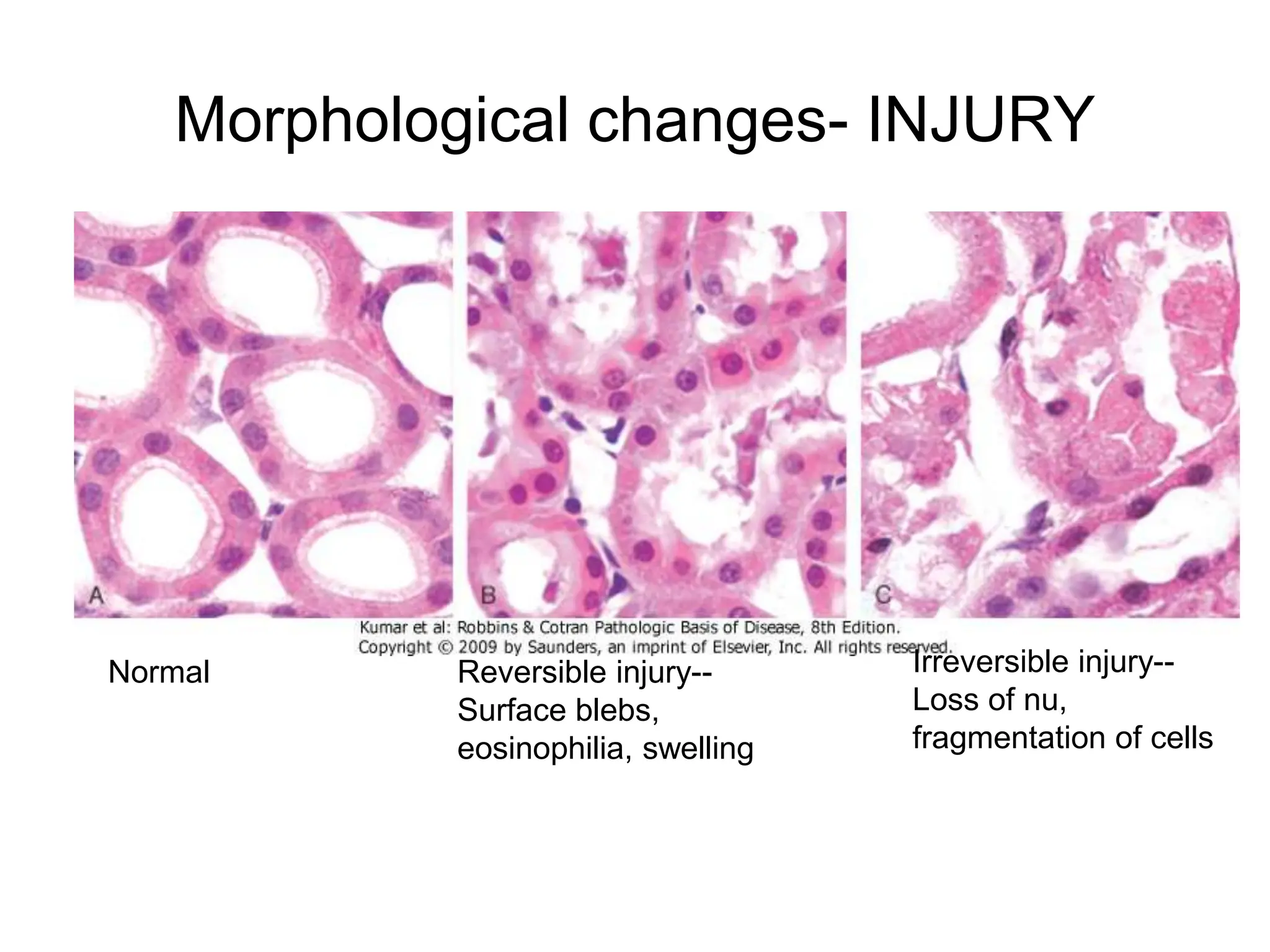 mech of cell injury, adaptation, necrosis.ppt
