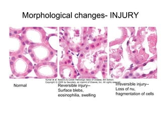 mech of cell injury, adaptation, necrosis.ppt