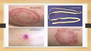 Cell Injury Pathology.pptx . | PPTX