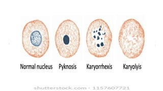 CELL INJURY.pptx cell injury cell injury | PPTX