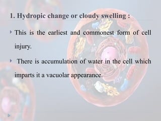 CELL INJURY (Reversible OR Irreversible Cell Injury | PPTX