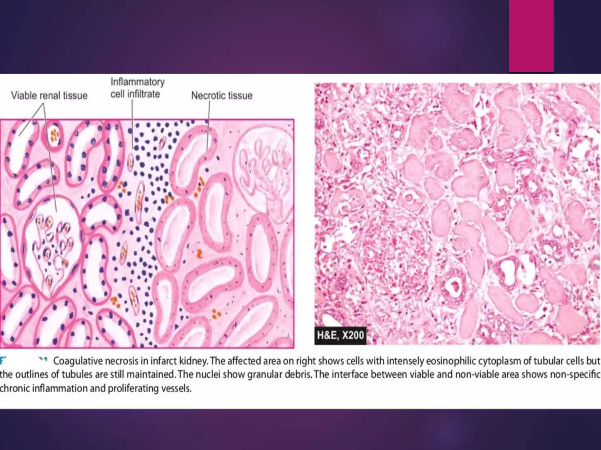 Cell injury-I Overview of cellular necrosis | PPTX