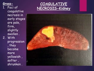 Cell injury-I Overview of cellular necrosis | PPTX