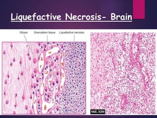 Cell injury-I Overview of cellular necrosis | PPTX