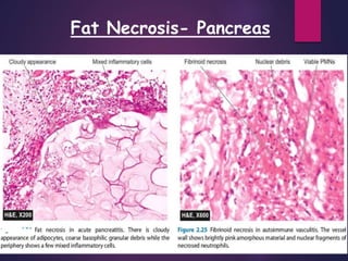 Cell injury-I Overview of cellular necrosis | PPTX