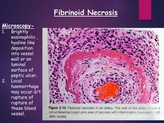 Cell injury-I Overview of cellular necrosis | PPTX