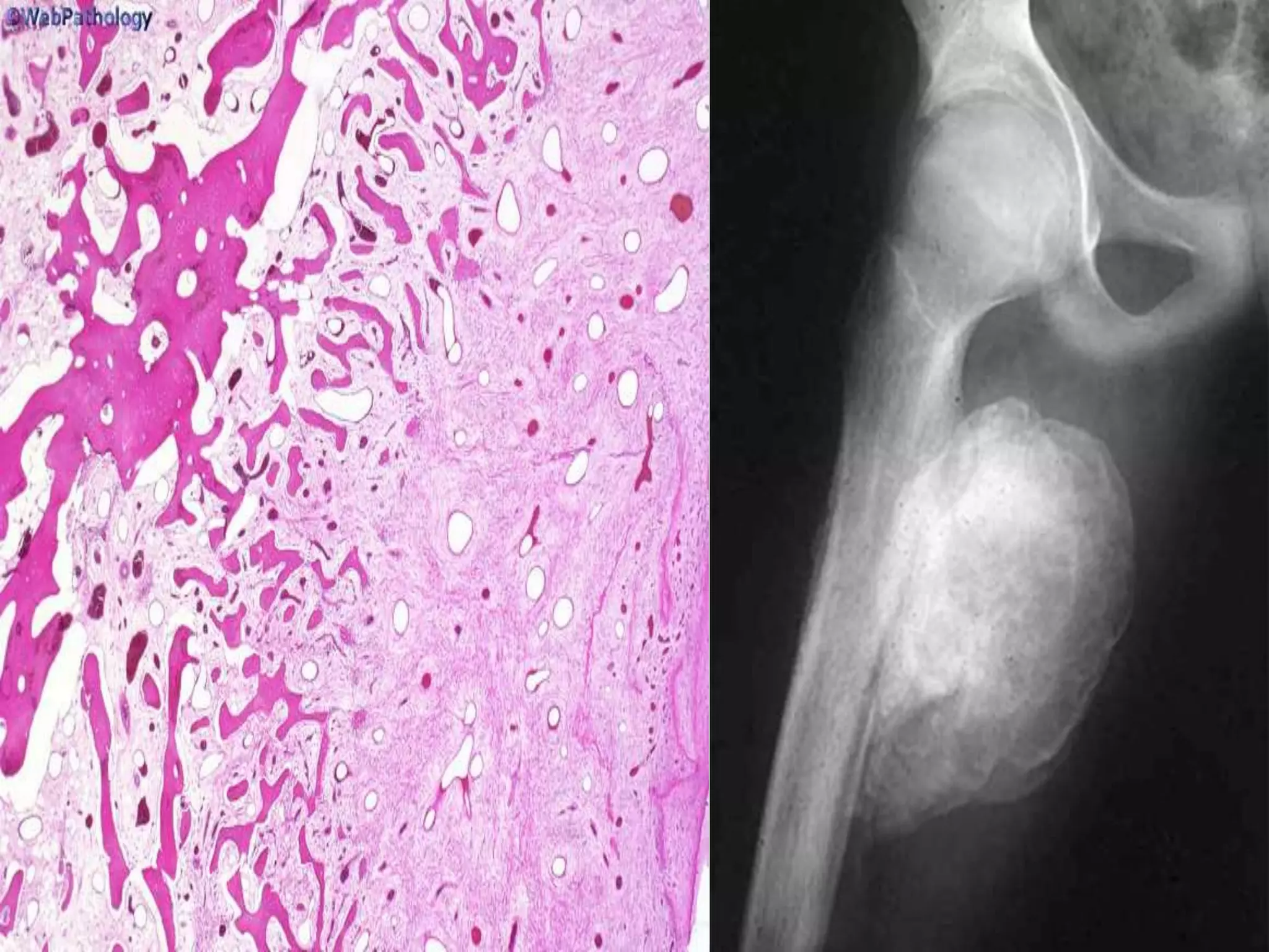 Cell injury metaplasia l autosaved] | PPTX