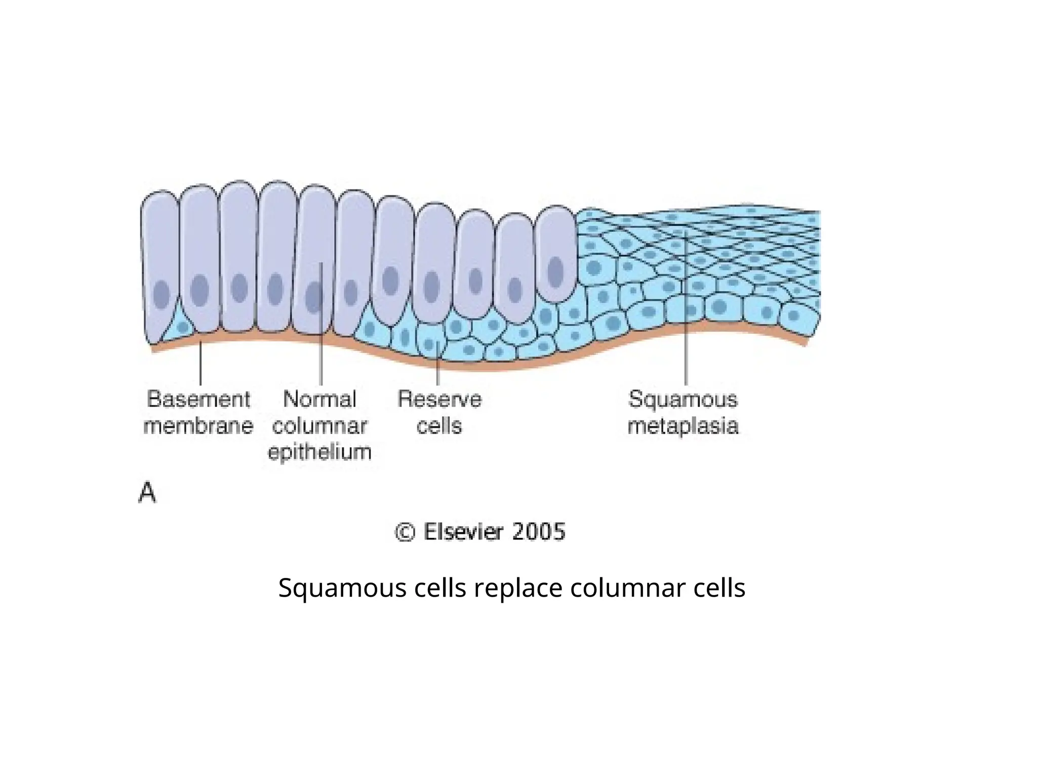 Cell injury-necrosis.ppt,types of necrosis, morphology | PPT