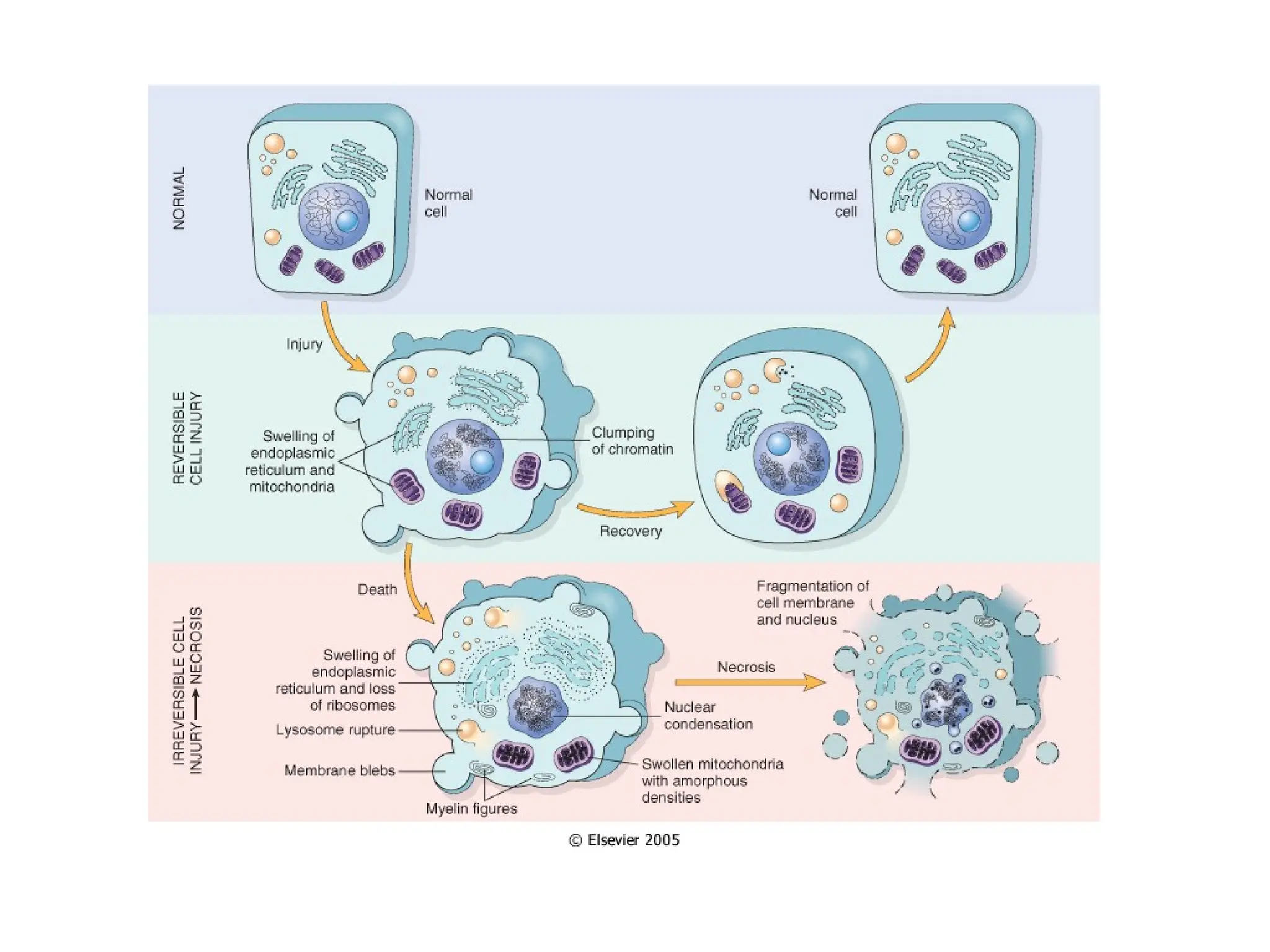 Cell injury-necrosis.ppt,types of necrosis, morphology | PPT