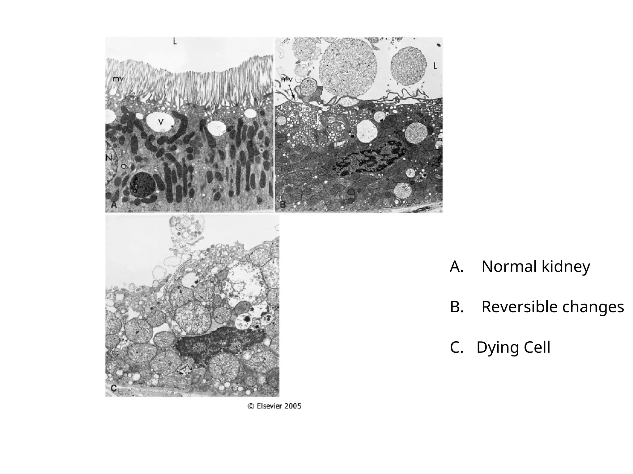 Cell injury-necrosis.ppt,types of necrosis, morphology | PPT