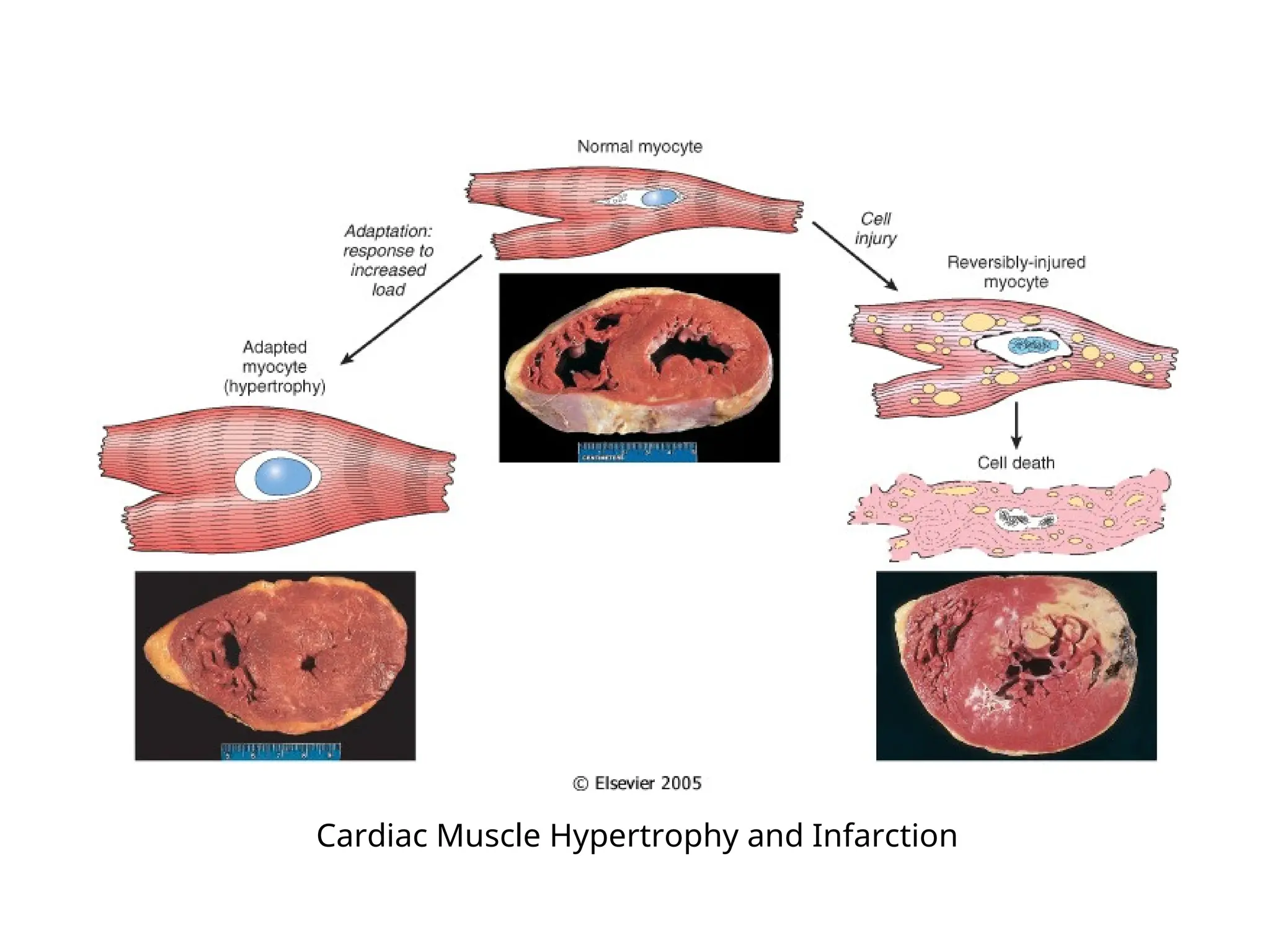 Cell injury-necrosis.ppt,types of necrosis, morphology | PPT