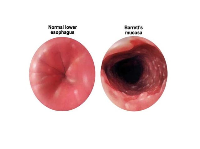 Cell injury-necrosis.ppt,types of necrosis, morphology | PPT
