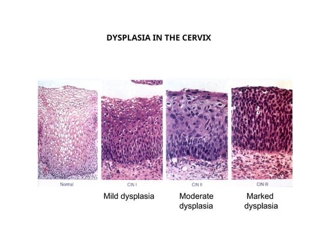 Cell injury-necrosis.ppt,types of necrosis, morphology | PPT