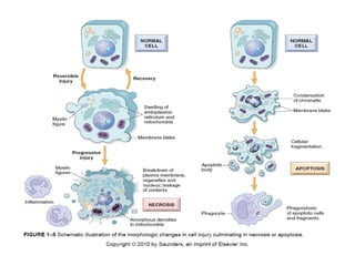 Cell injury-necrosis.ppt,types of necrosis, morphology | PPT