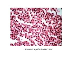 Cell injury-necrosis.ppt,types of necrosis, morphology | PPT