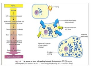 Cell injury | PPTX