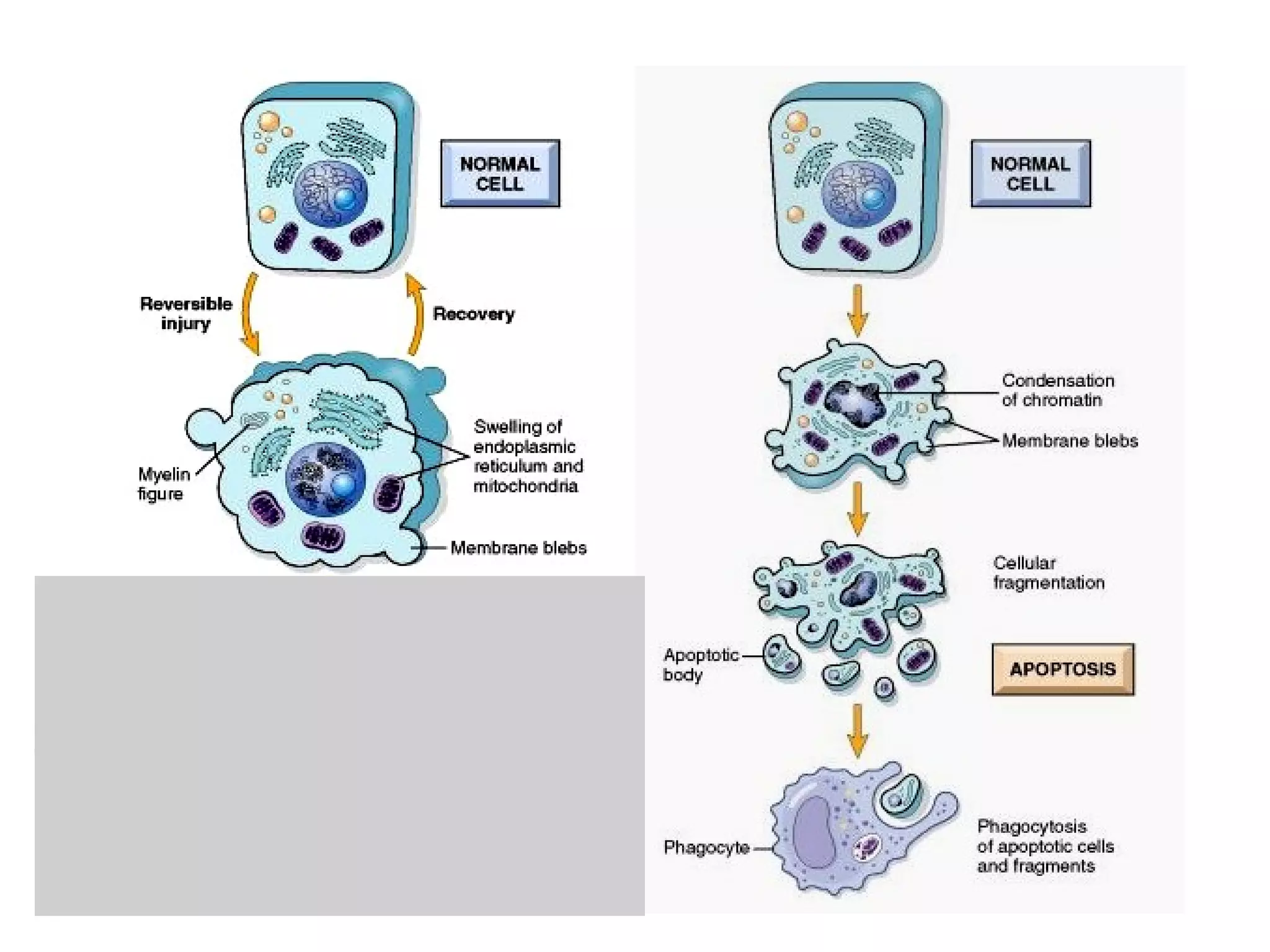 Cell injury: causes, pathogenesis, Morphology of reversible cell injury ...