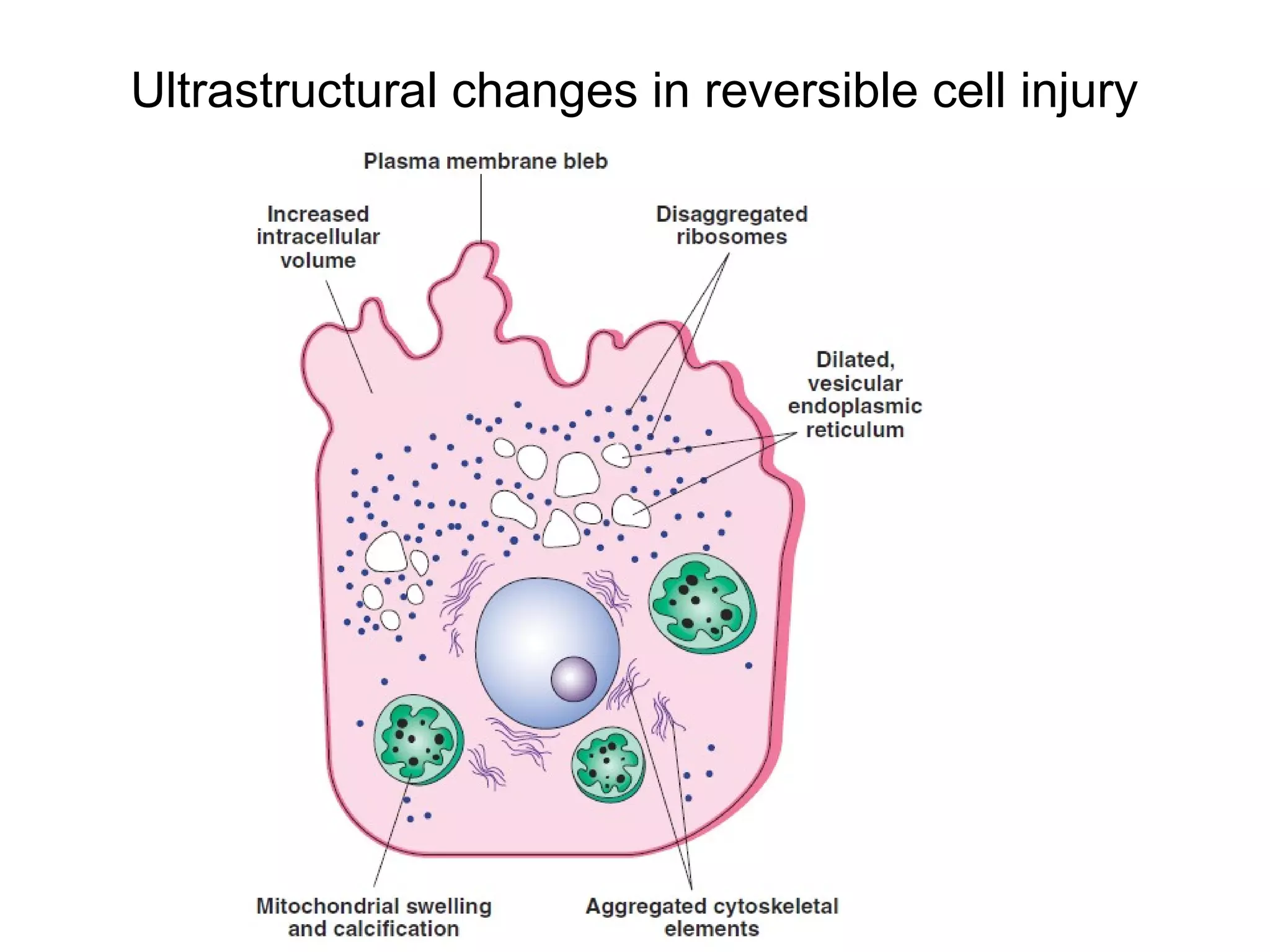 Cell injury: causes, pathogenesis, Morphology of reversible cell injury ...