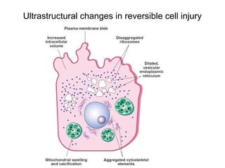 Cell injury: causes, pathogenesis, Morphology of reversible cell injury ...