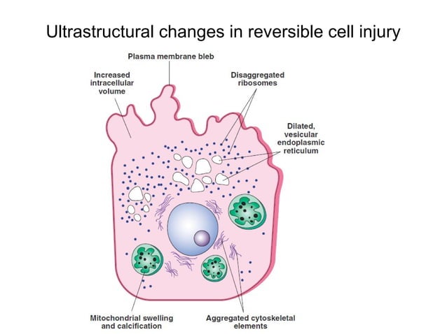 Cell injury: causes, pathogenesis, Morphology of reversible cell injury