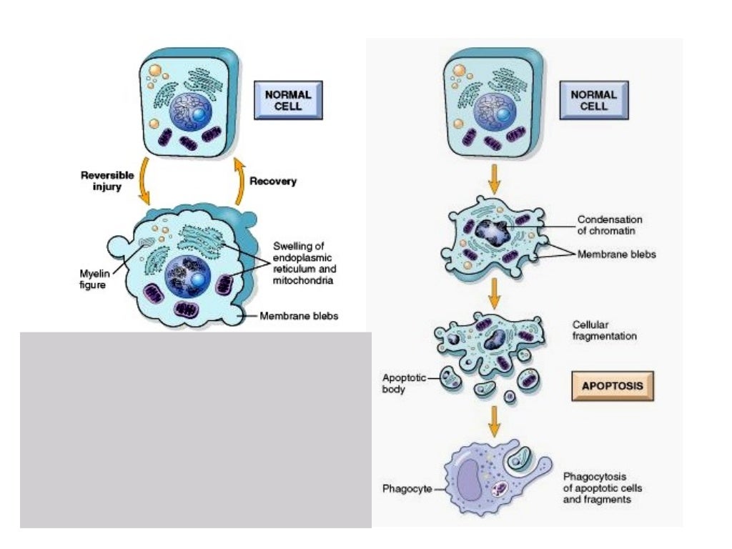 Cell injury: causes, pathogenesis, Morphology of reversible cell inju…