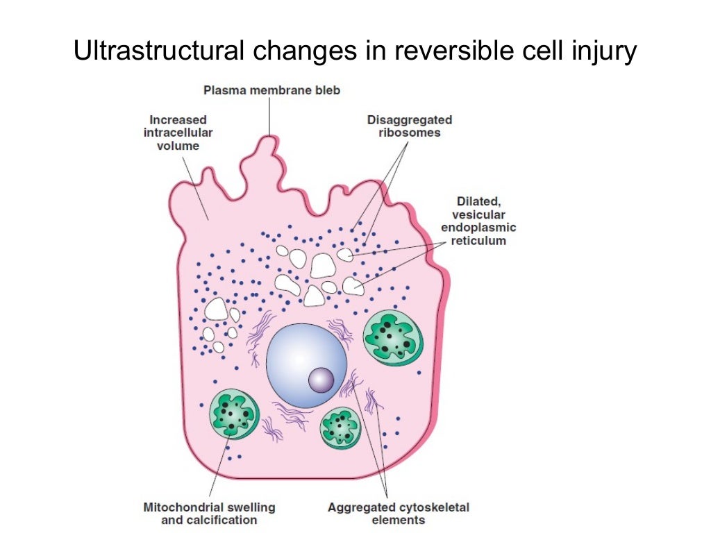 Cell injury: causes, pathogenesis, Morphology of reversible cell inju…
